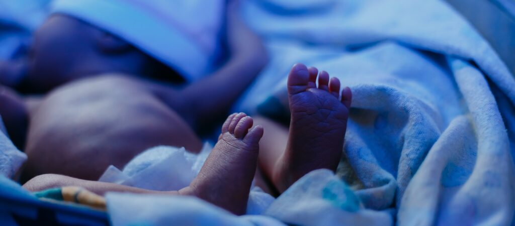 Neonatal Jaundice Test Johor Bahru | Klinik Bayu Bilirubin